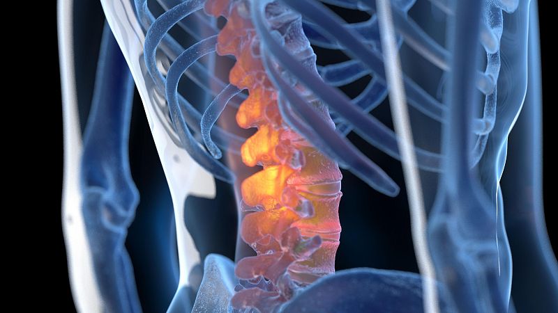 Recomanen evitar pràctiques de risc per prevenir les lesions medul·lars