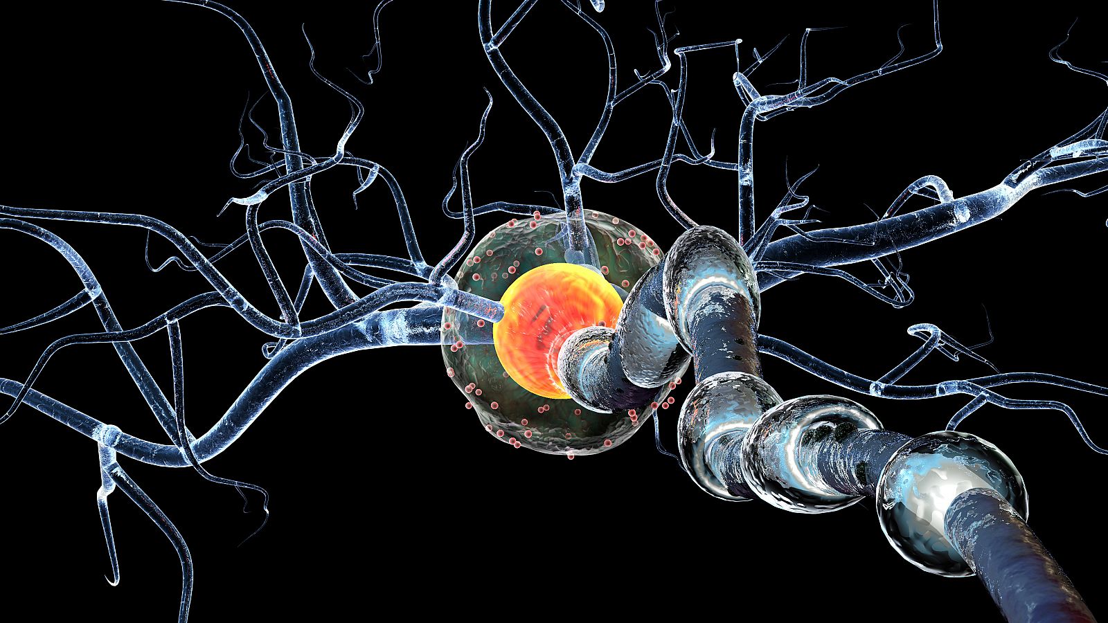 La esclerosis múltiple, una enfermedad de síntomas. RTVE.es