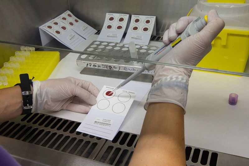 Crida a la prevenció del càncer de cap i coll