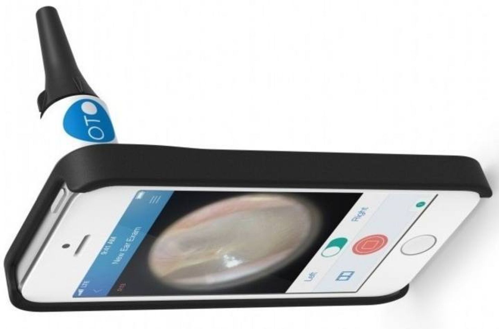 Un accesorio convierte el móvil en un otoscopio para diagnosticar ...