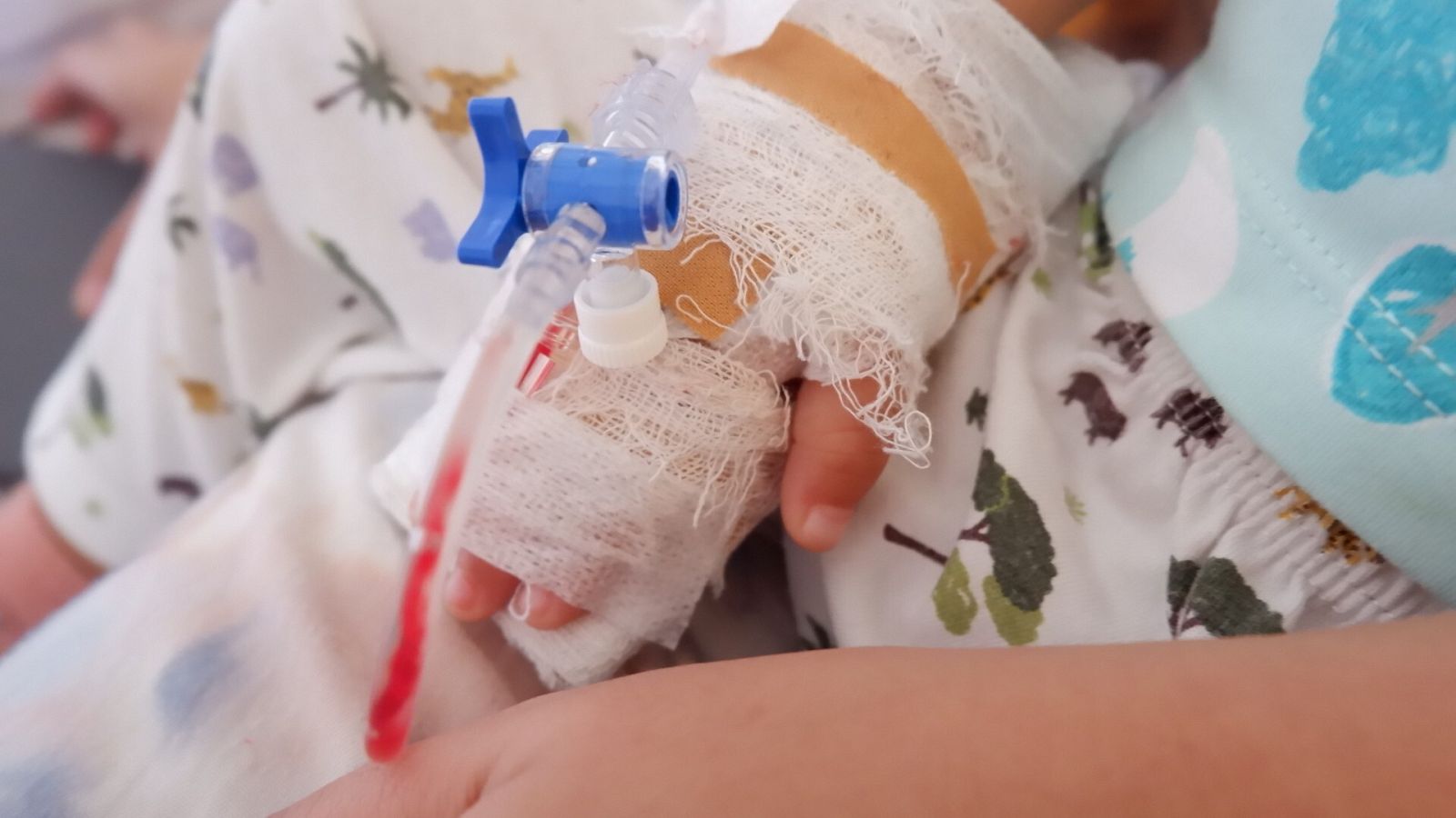 Fisiologia Del Corazon De Bebe