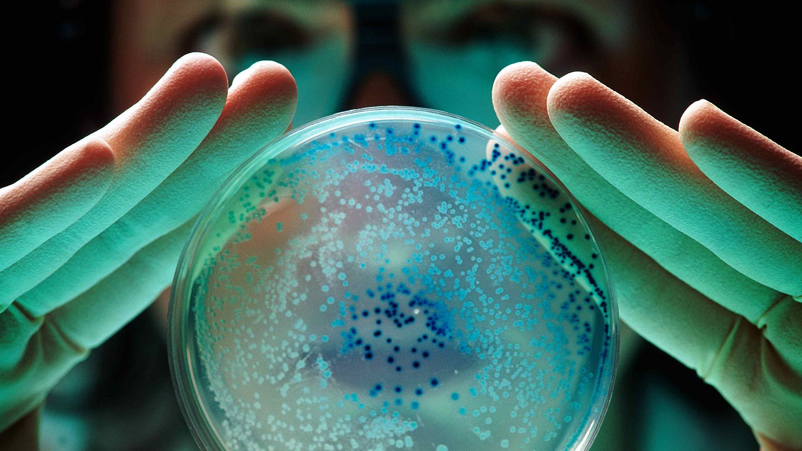 Bacterias resistentes: cuando una simple ampolla puede ser mortal