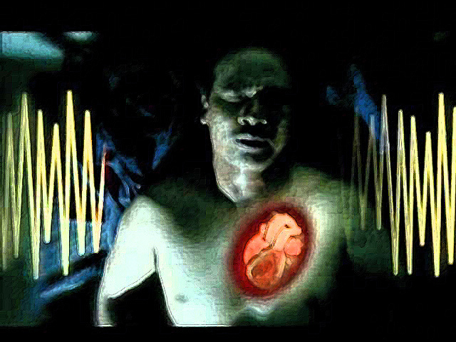 Documentos TV. "Muerte súbita" - RTVE.es