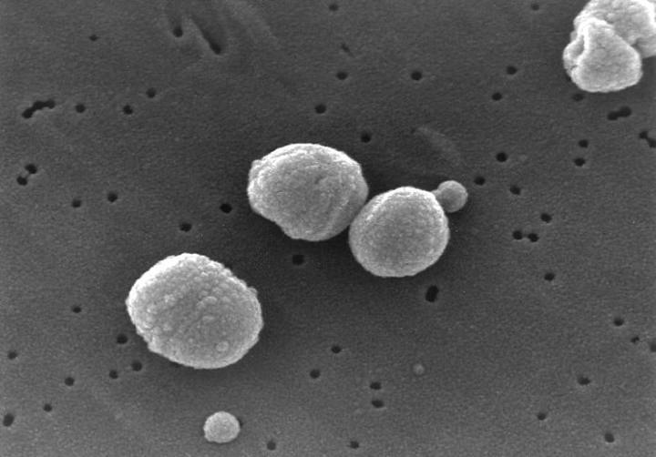 Identifican el mecanismo de división celular del neumococo, la bacteria ...