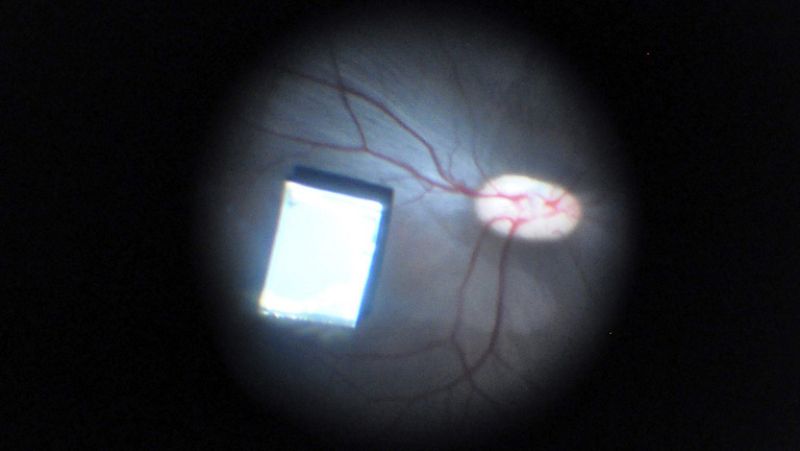Telediario 1: Científicos israelíes desarrollan una nano retina, un ...