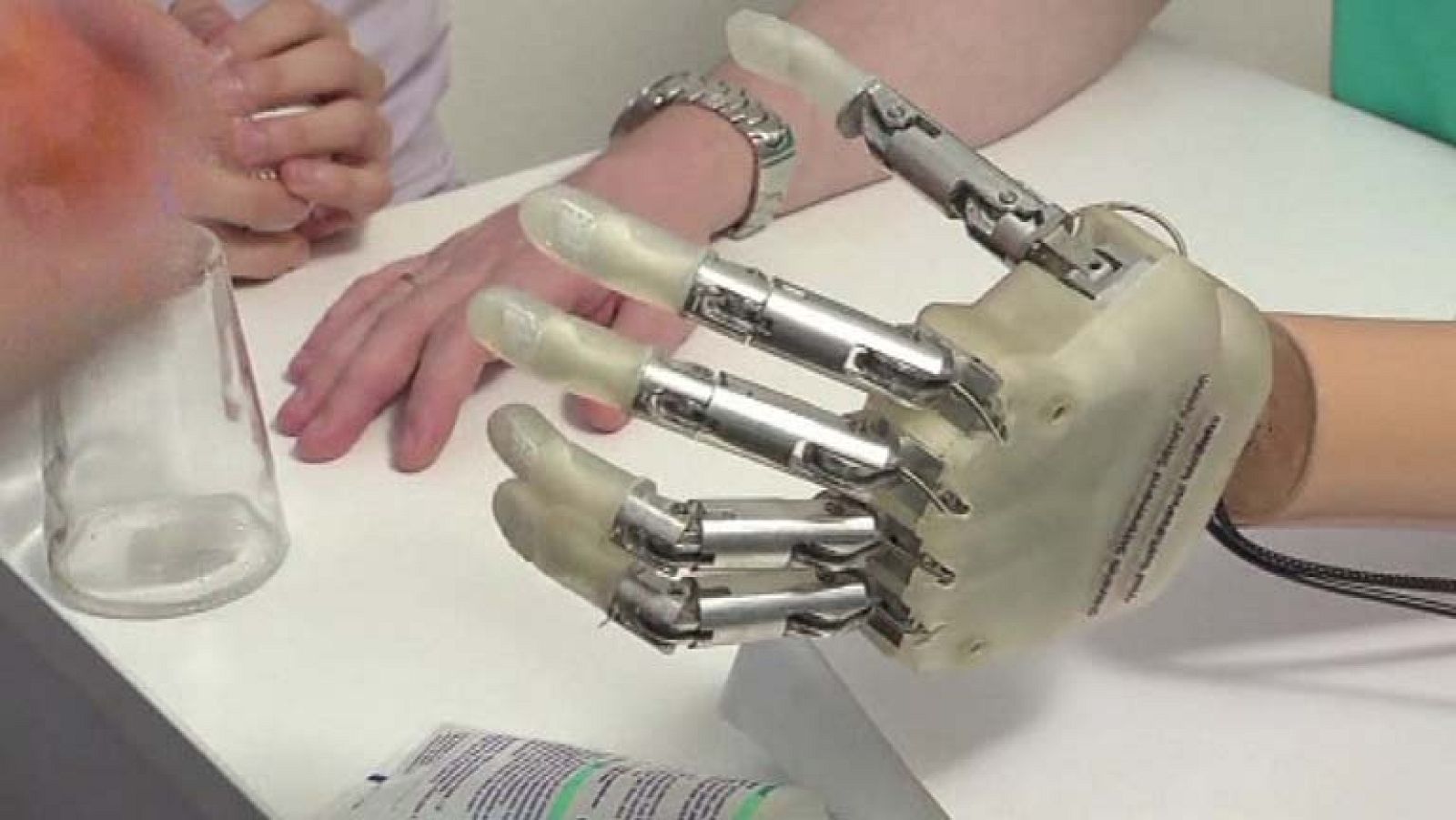 Una mano biónica permite a un paciente volver a sentir los objetos y ...