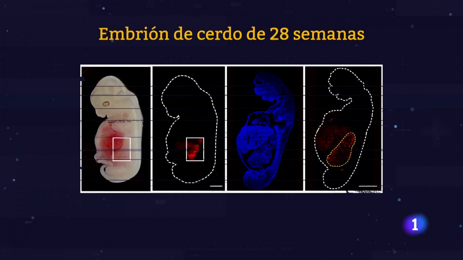 Cultivan riñones humanos en embriones de cerdo durante 28 días Cultivan riñones humanos en embriones de cerdo durante 28 días
