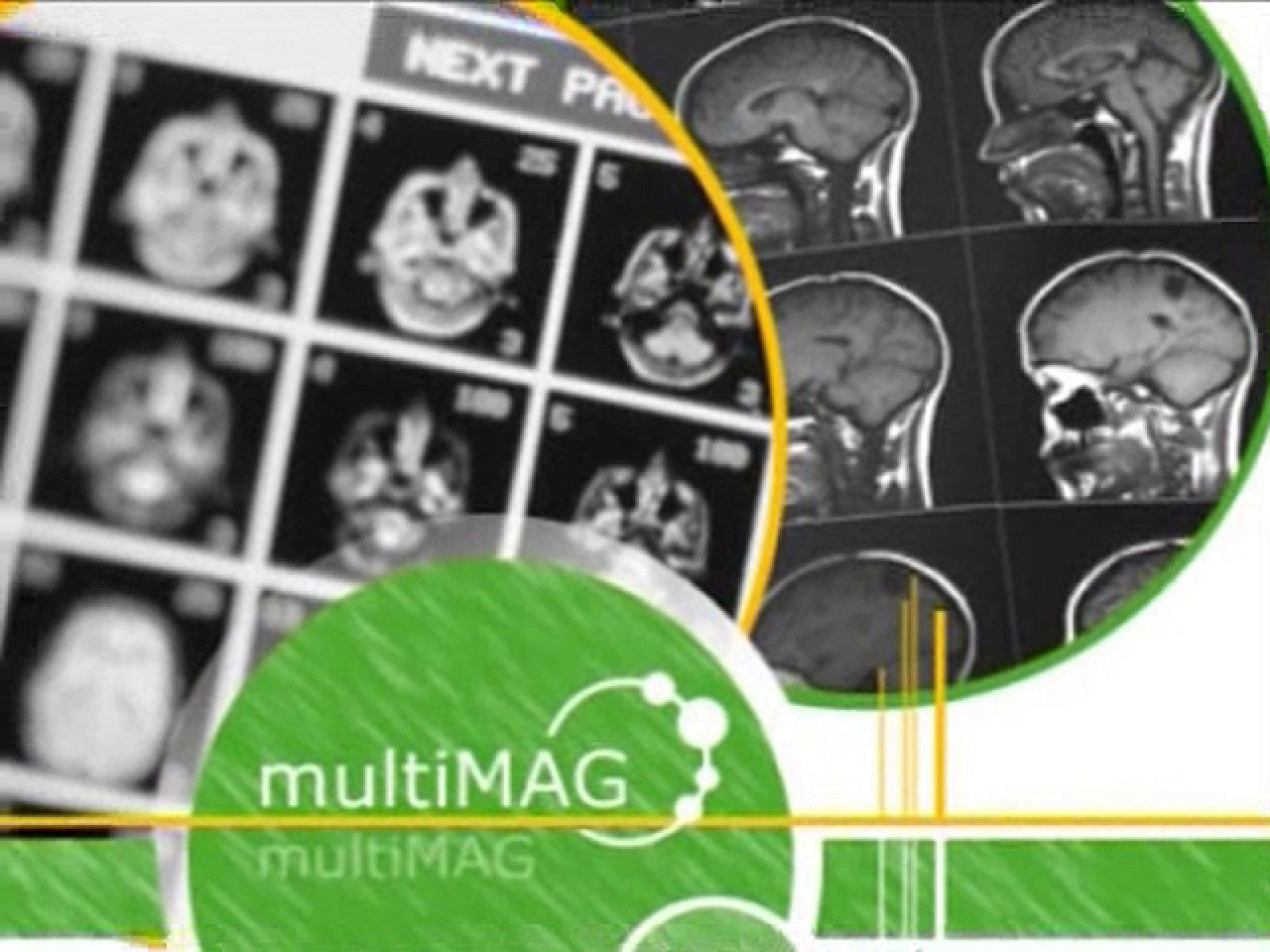 UNED: MULTIMAG | RTVE Play